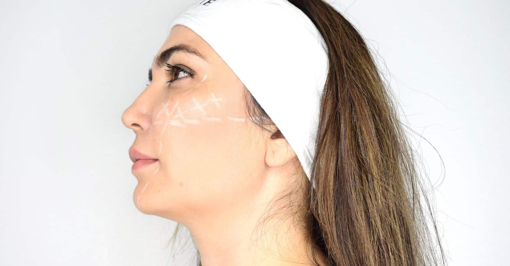Botox for forehead | Derma Institute